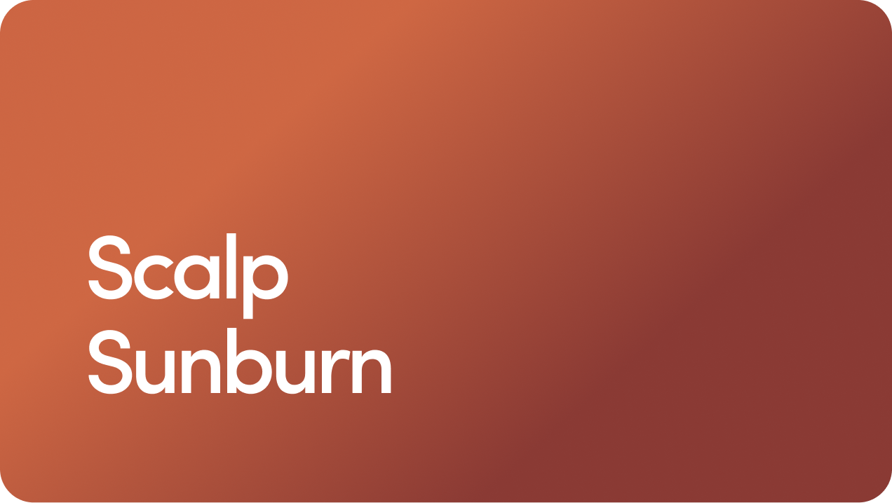 Scalp Sunburn: Symptoms & Causes | Good Health by Hims