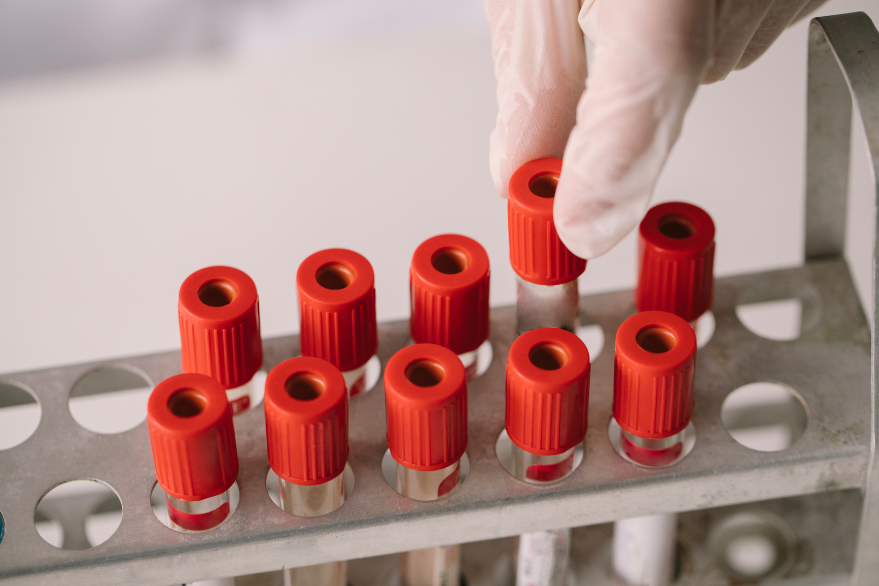 Understanding Blood Tests: How They Work and What They Can Tell You ...
