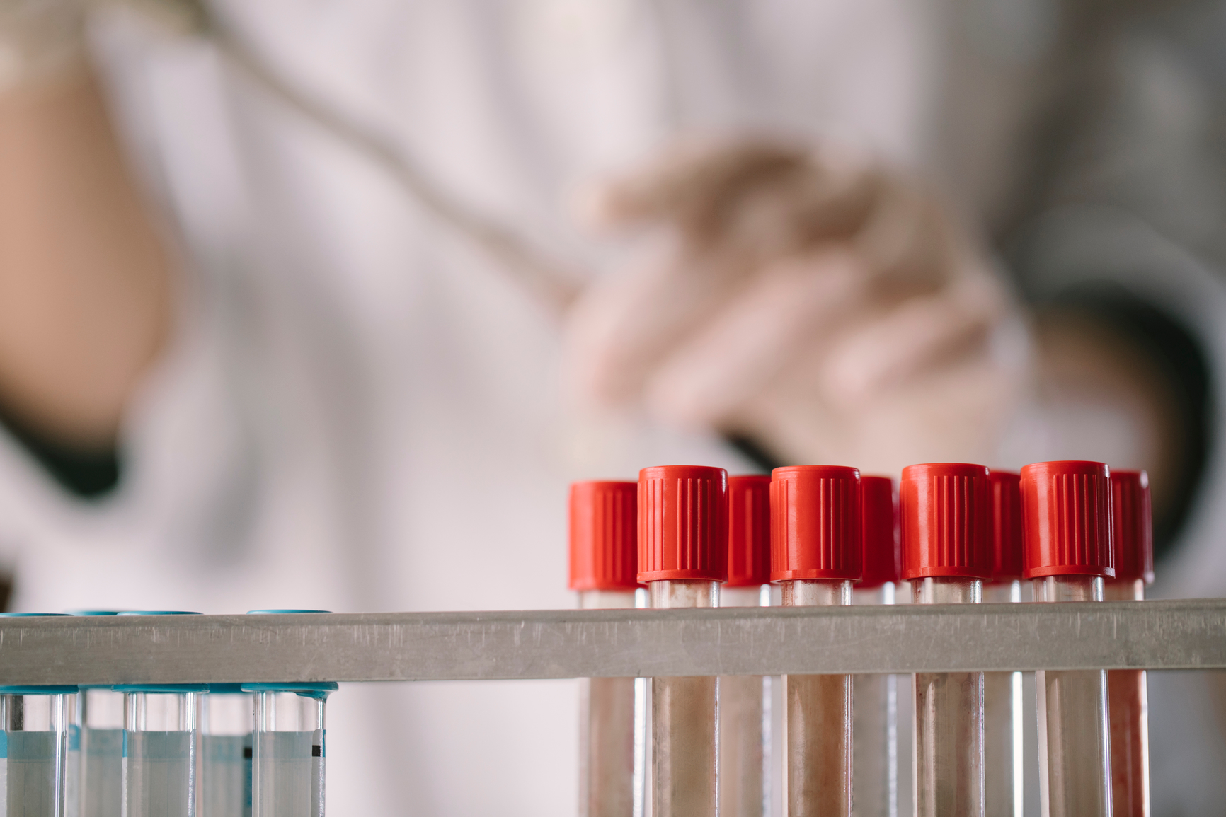 Functional vs. Conventional Blood Testing: Which Is Right for You ...